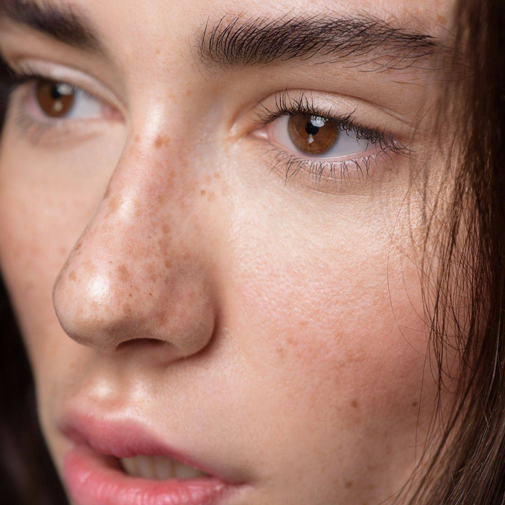 What is the Difference Between Sensitive and Sensitised Skin? – GLO ...